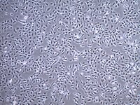 TC28a2 Human Chondrocyte Cell Line | SCC042